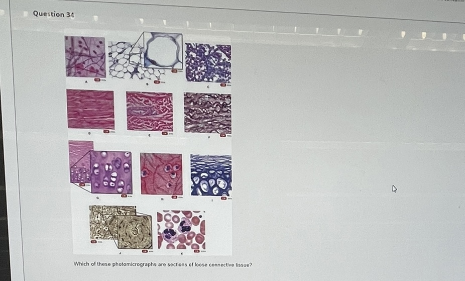 Solved Unlike compact bone, spongy bone forms a meshwork of | Chegg.com