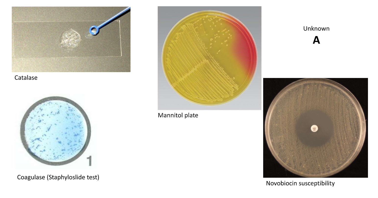 Solved Catalase Mannitol plate Coagulase (Staphyloslide | Chegg.com