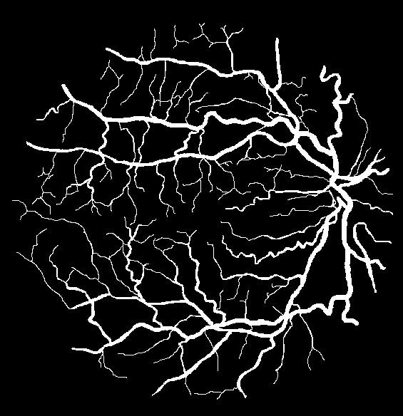Retinal vessel segmentation using python This is the | Chegg.com