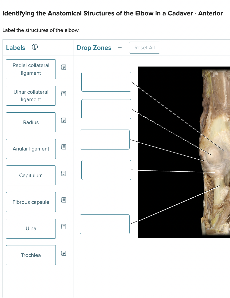 Solved Identifying the Anatomical Structures of the Elbow in | Chegg.com