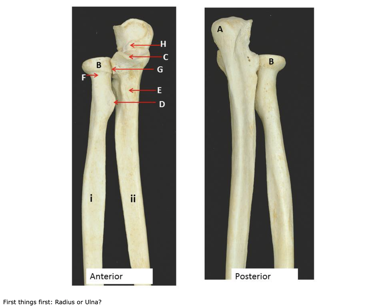Solved Using the drop boxes below, identify the following | Chegg.com