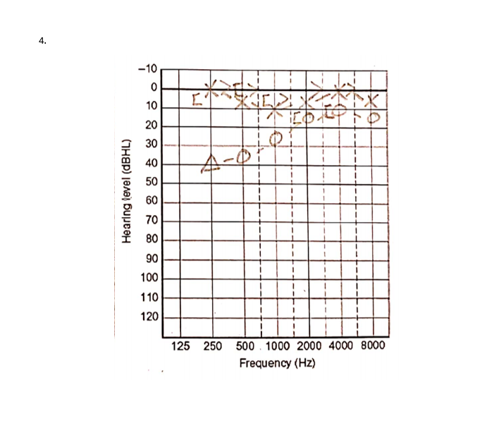 Solved Instructions: Interpret the audiograms below and | Chegg.com