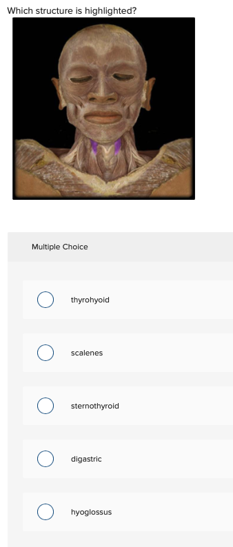 Solved Which structure is highlighted? Multiple Choice | Chegg.com