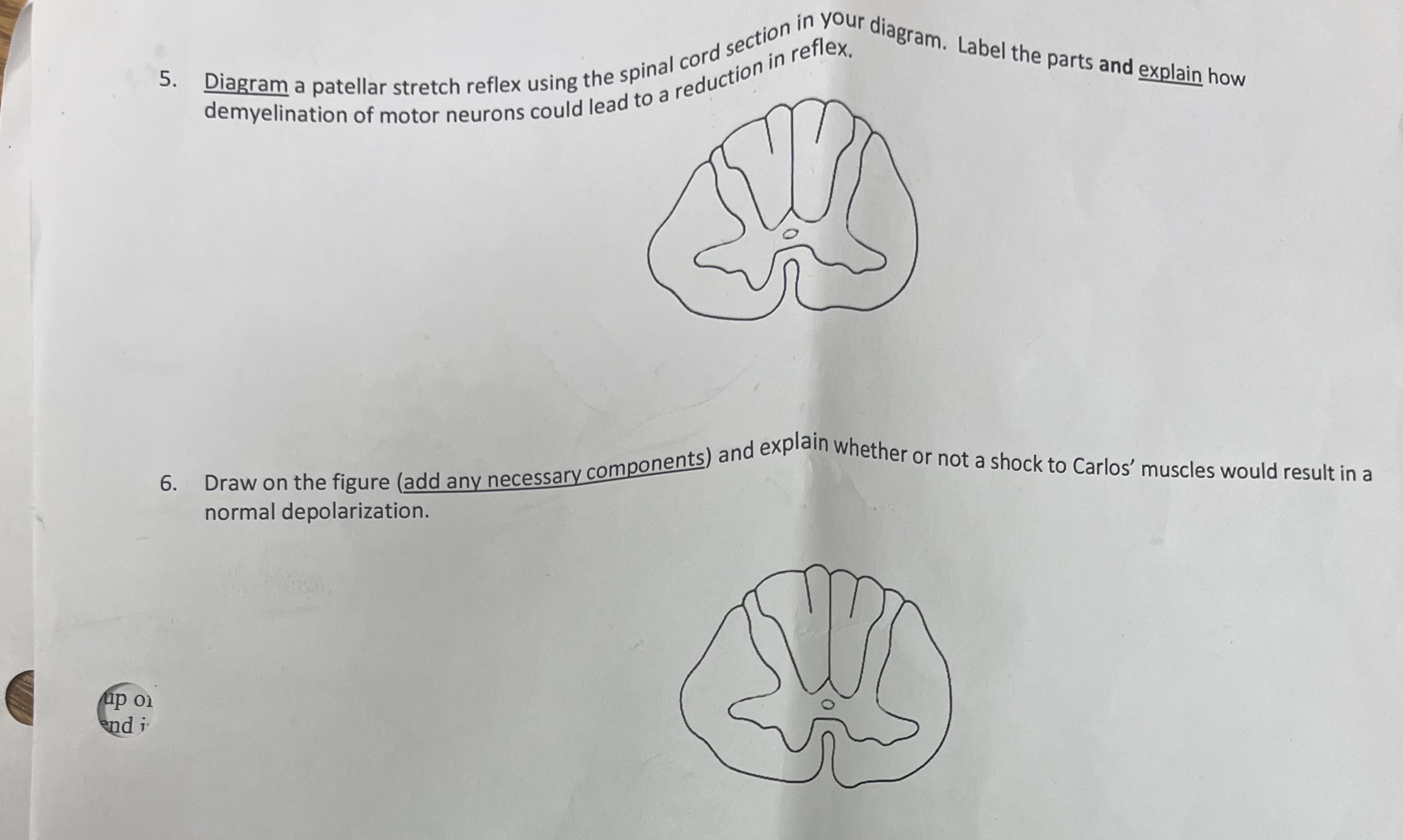 Solved 5. Diagram a patellar stretch reflex using the spinal | Chegg.com