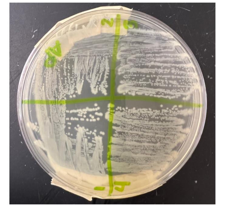 Solved Did any bacteria grow in your NA plate? Did you get | Chegg.com