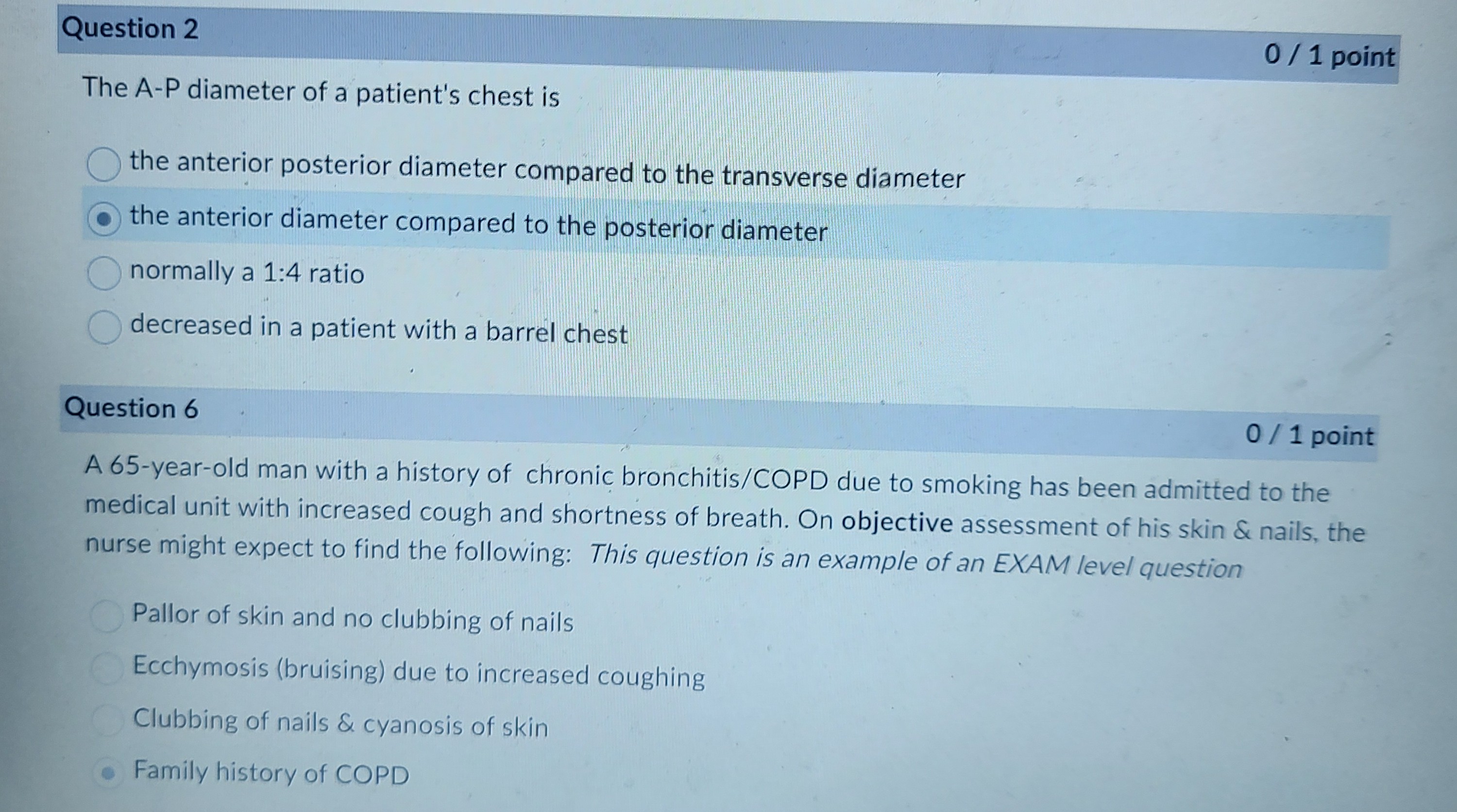 Solved \\( 0 / 1 \\) point The A-P diameter of a patient's | Chegg.com