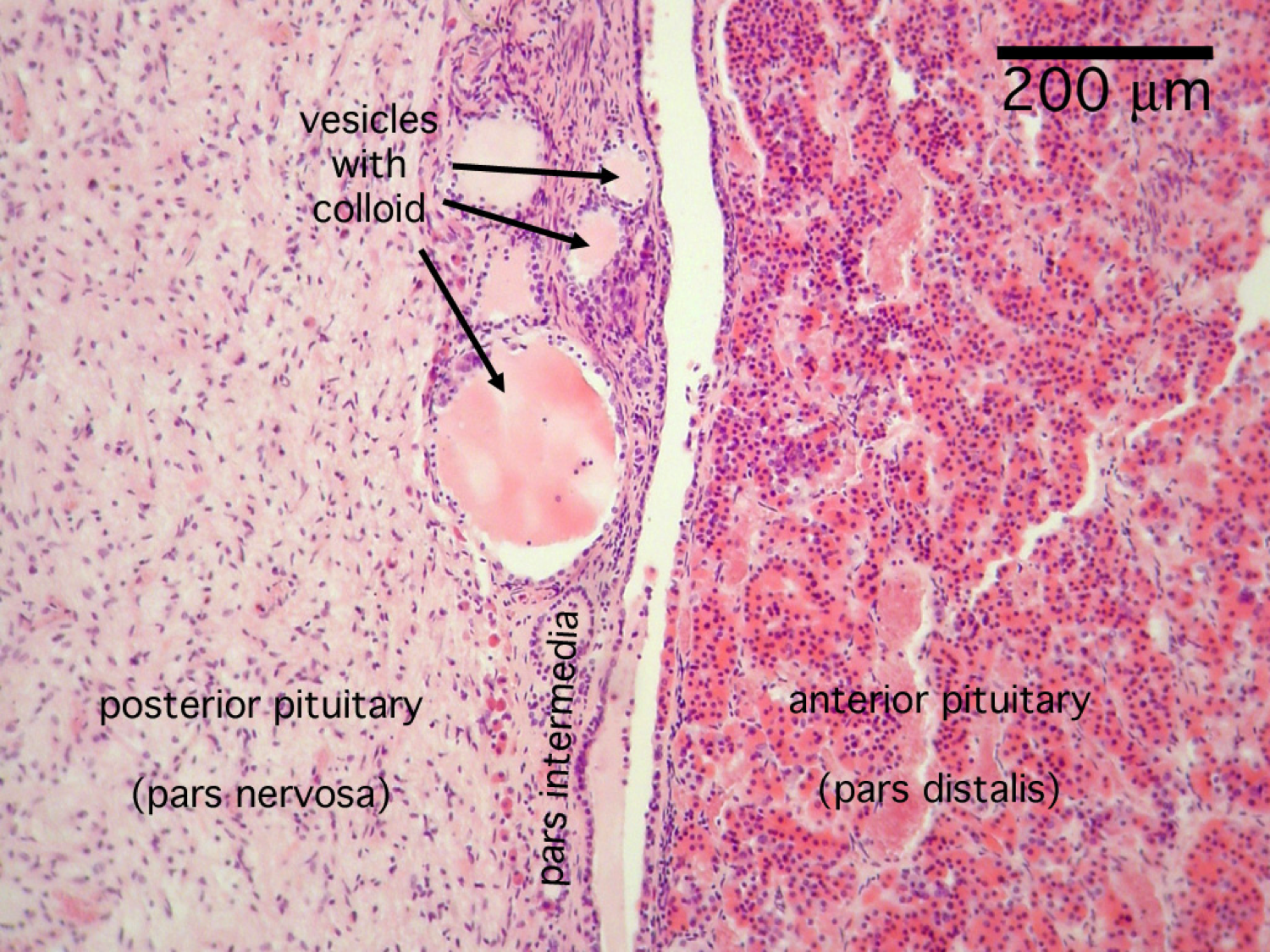 Pituitary Gland Histology Labeled