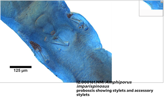 Solved 125 pm IZ.000161.NM.Amphiporus imparispinosus | Chegg.com