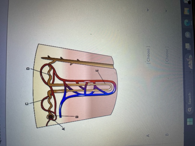 Solved options are 1.Distal Convoluted Tubule 2. Nephron | Chegg.com