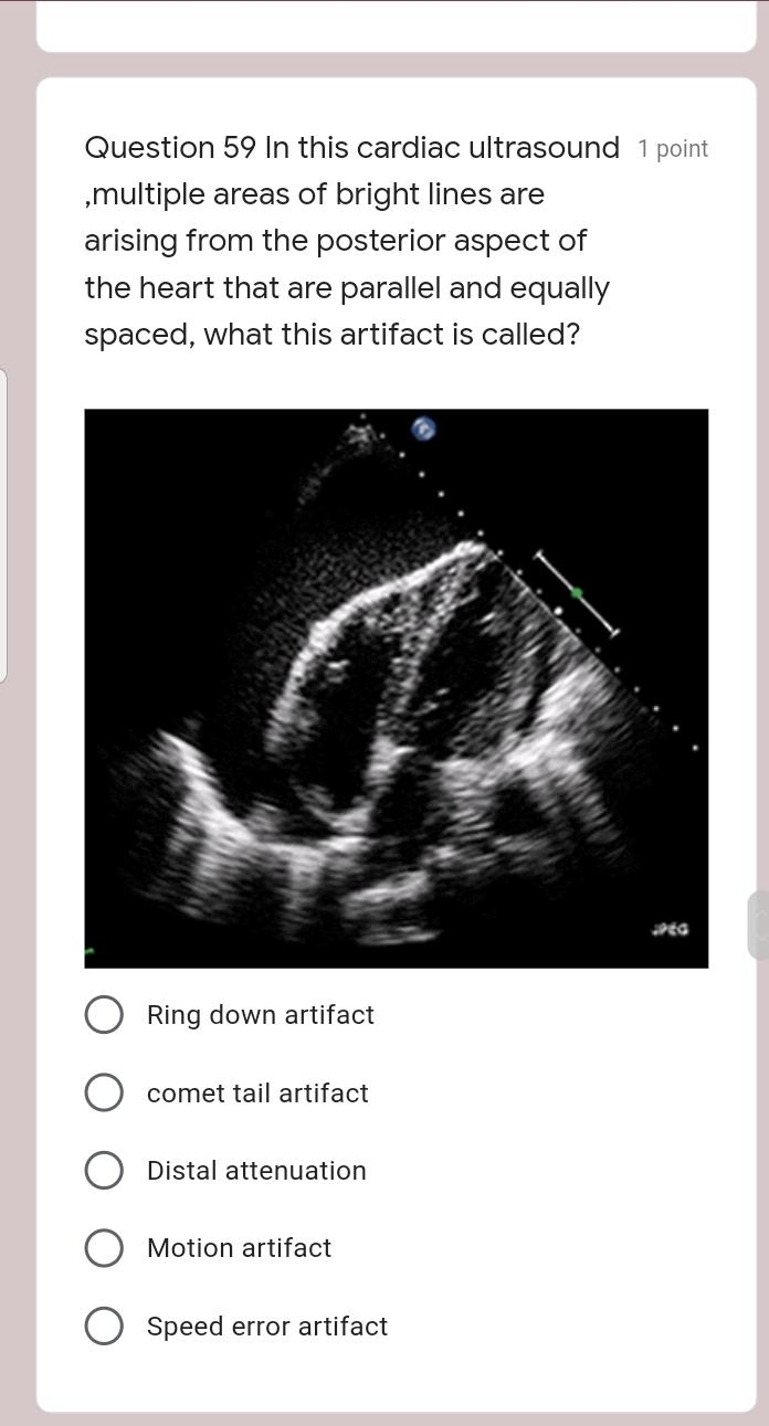 Solved Question 59 In this cardiac ultrasound 1 point | Chegg.com