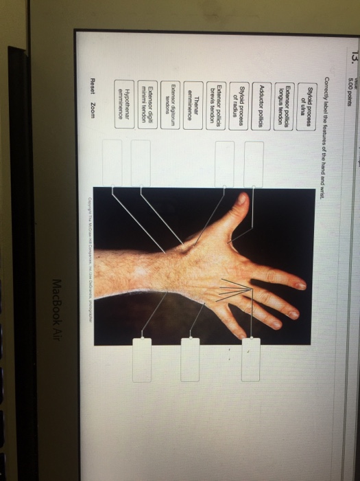 Solved Correctly label the features of the hand and wrist | Chegg.com