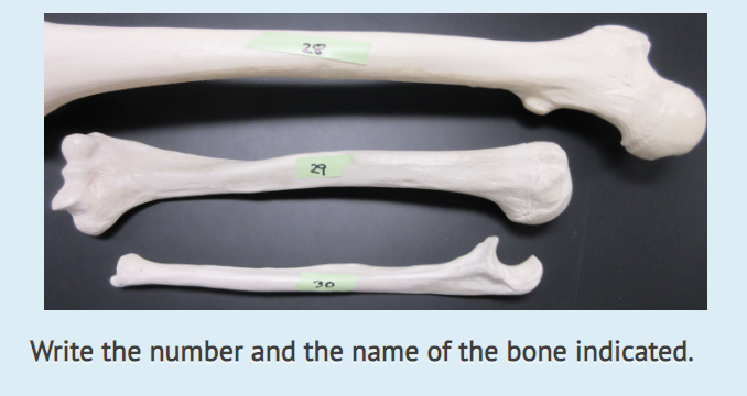 Solved 25 29 Write the number and the name of the bone | Chegg.com