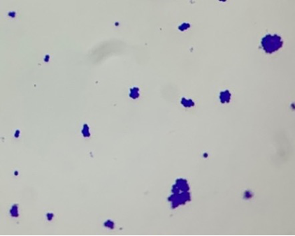 Solved WHAT IS THE IDENTIFICATION OF THE UNKNOWN BACTERIA | Chegg.com