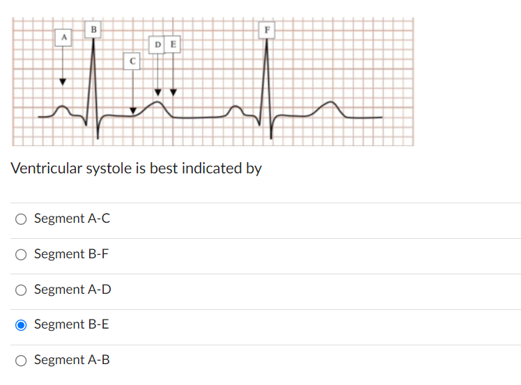 Solved Ventricular systole is best indicated bySegment | Chegg.com