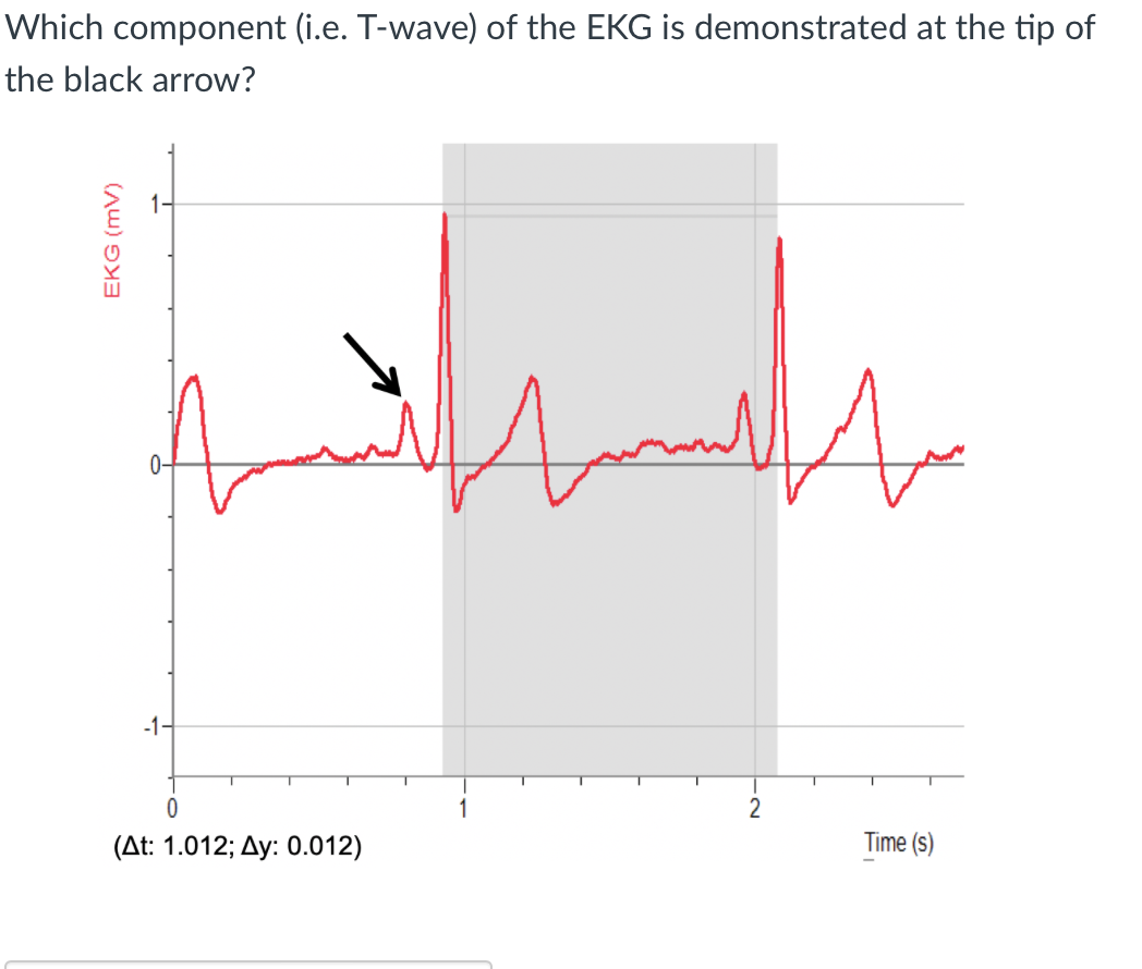 Solved Which component (i.e. ﻿T-wave) ﻿of the EKG is | Chegg.com