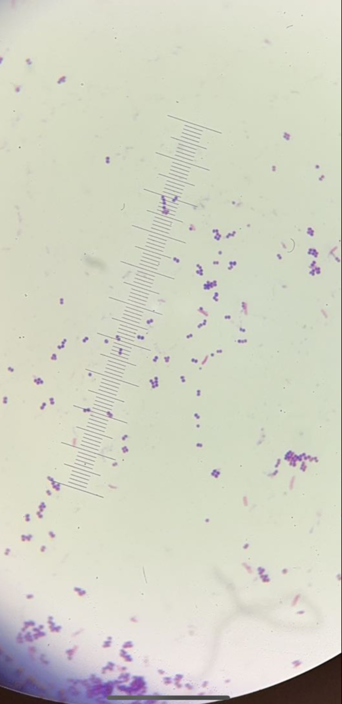 Solved What is the arrangement of the cocci bacteria shown | Chegg.com