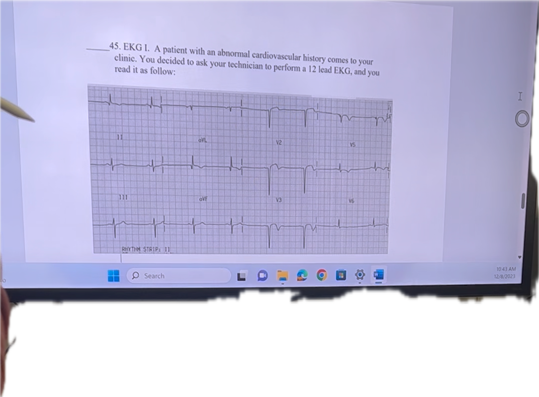 Solved Cardio Review 1. Cardiac cycle runs in systole and | Chegg.com