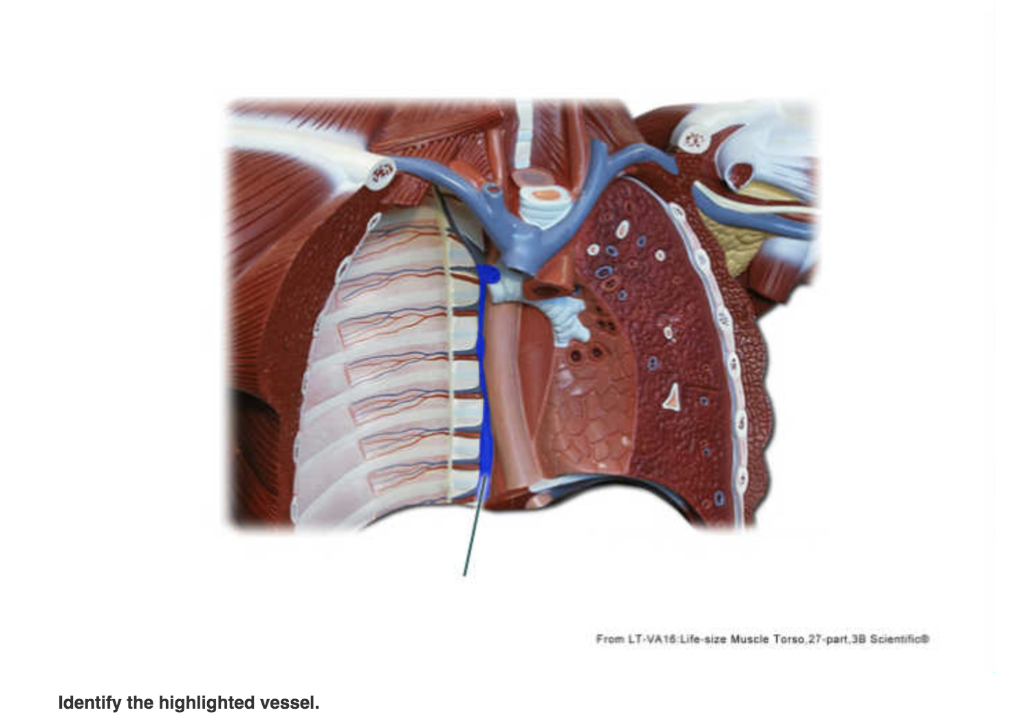 Identify the highlighted structure. From LT VA18 | Chegg.com