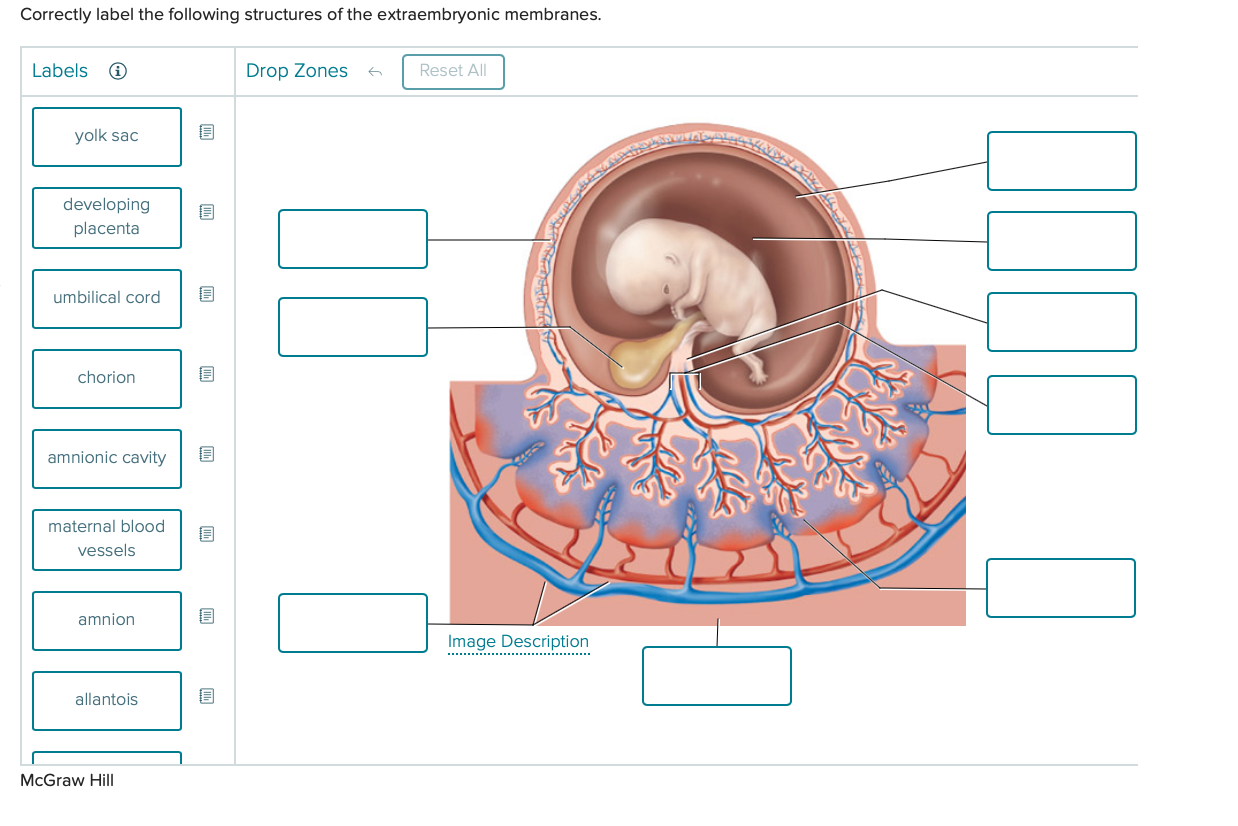 Solved Correctly label the following structures of the | Chegg.com