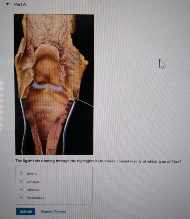 Solved Part A Which structure is highlighted? O o right main | Chegg.com