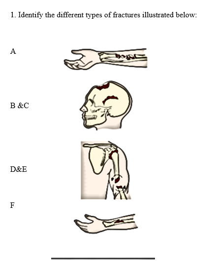 Solved 1. Identify the different types of fractures | Chegg.com