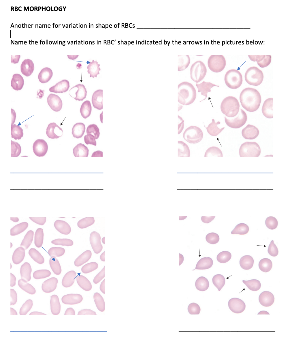Solved RBC MORPHOLOGY Another name for variation in shape of | Chegg.com