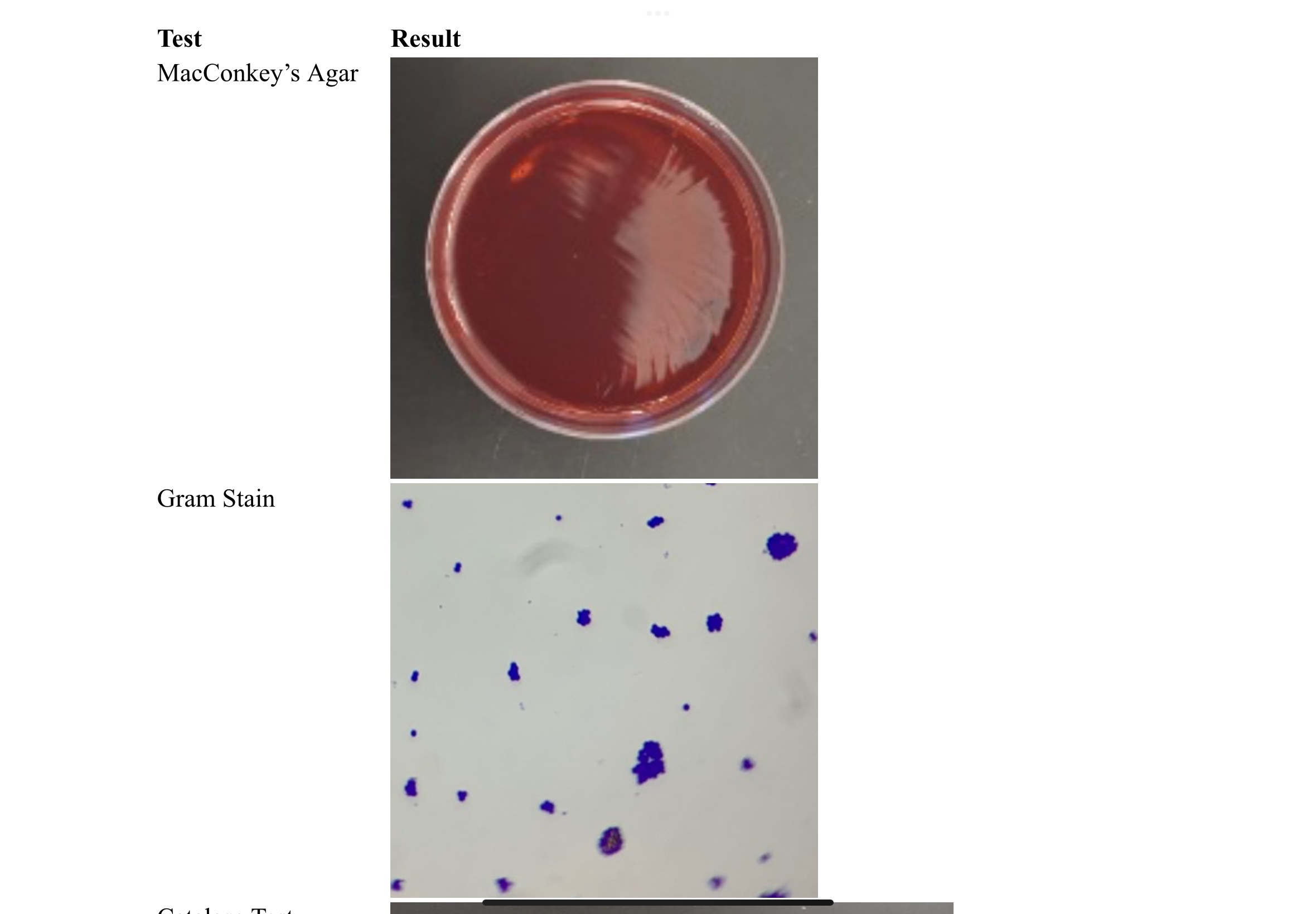 Solved Test MacConkey's Agar Esculin ID Membrane Nutrient | Chegg.com