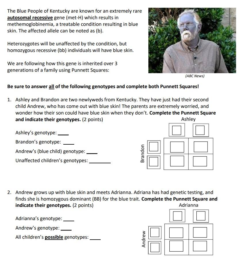 Solved The Blue People of Kentucky are known for an | Chegg.com