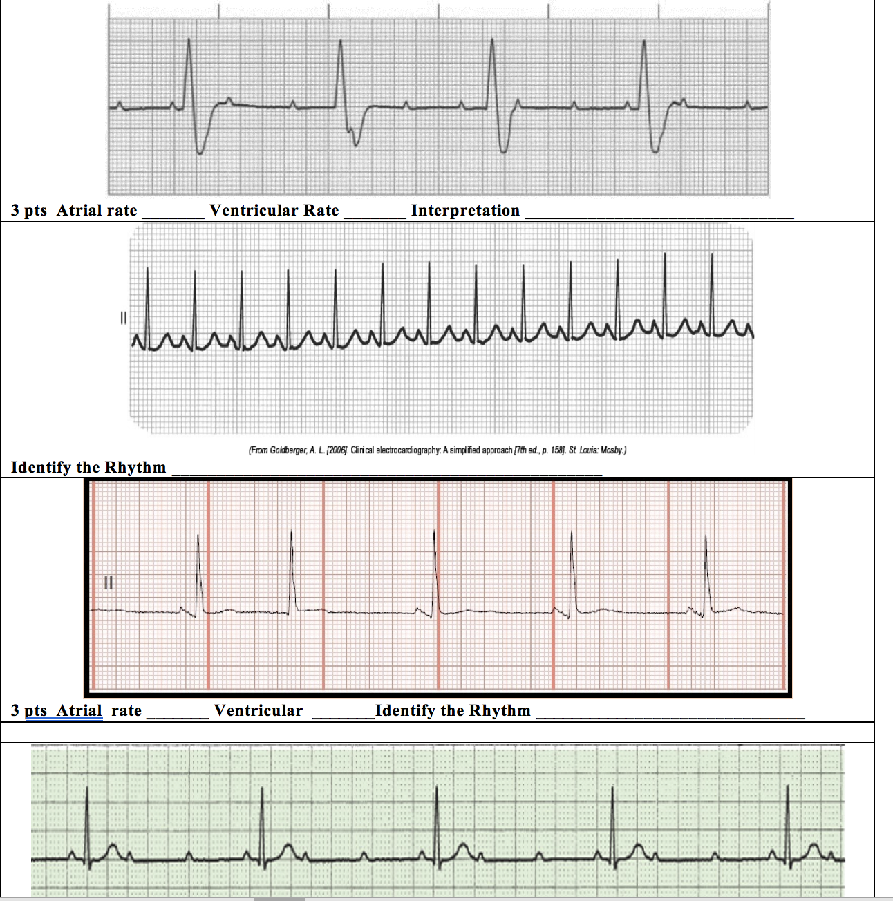 Solved اااااااااااا Identify the Rhythm Identify the Rhythm | Chegg.com