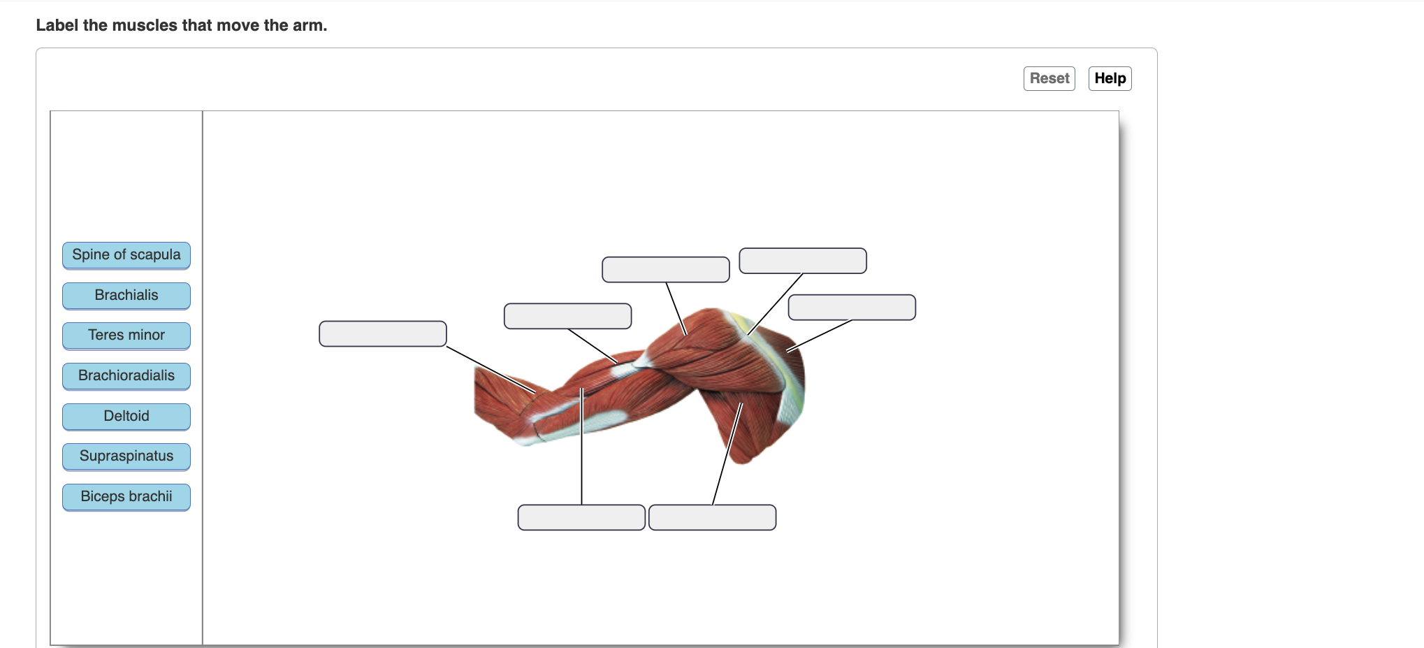 Solved Label the muscles that move the arm. | Chegg.com