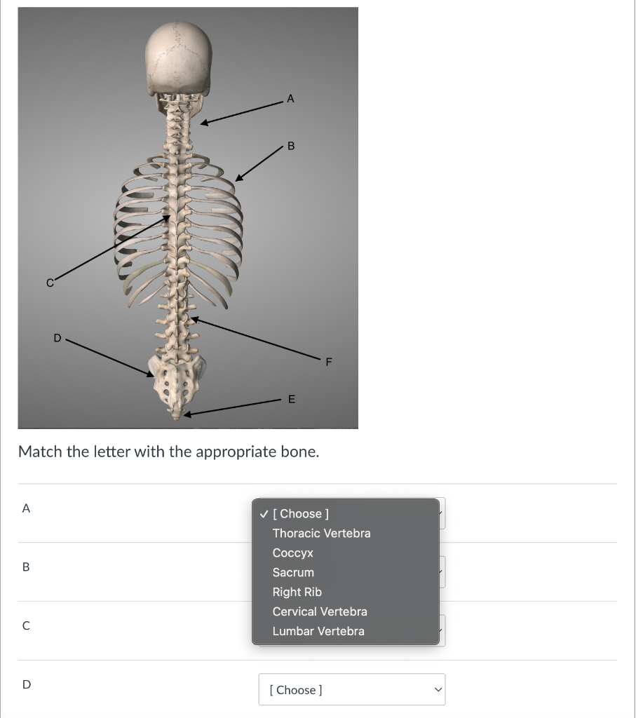 Solved Name the feature that is highlighted Manubrium | Chegg.com