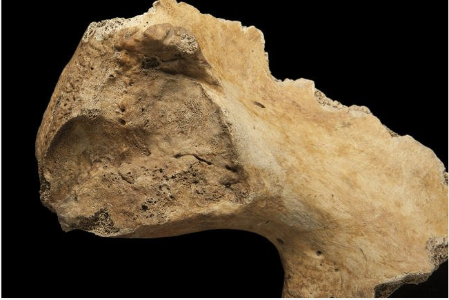 Adult Age Estimation from Auricular Surface: Indicate | Chegg.com