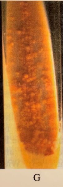 Solved The bacterial growth pattern on agar slant Tube D is | Chegg.com