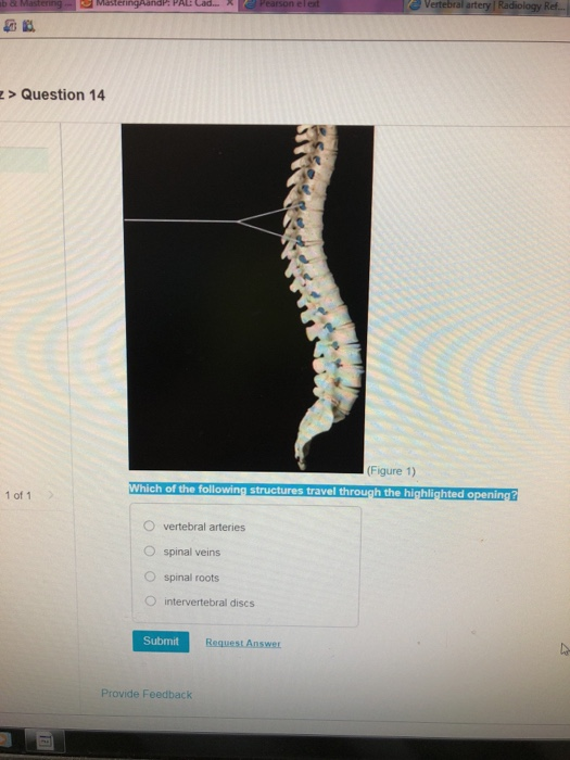 Solved Masteri e Vertebral artery Ra >Question 14 (Figure 1) | Chegg.com