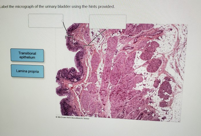 Solved Kidney Ureter perirenal fat Suprarenal gland Urinary | Chegg.com
