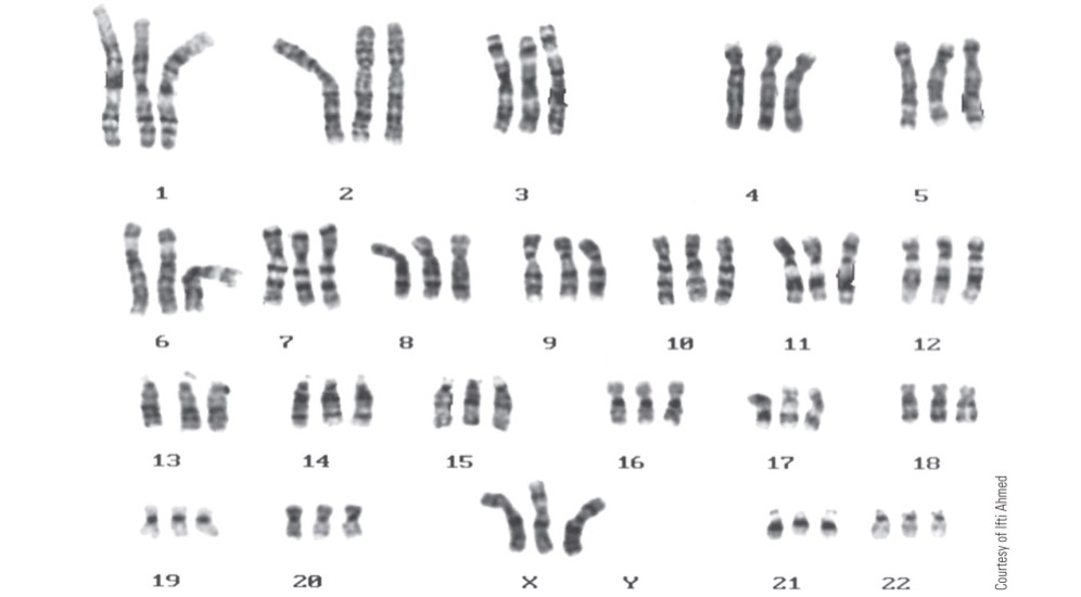 Solved Does karyotype 2 depict a polyploid or an anueploid | Chegg.com