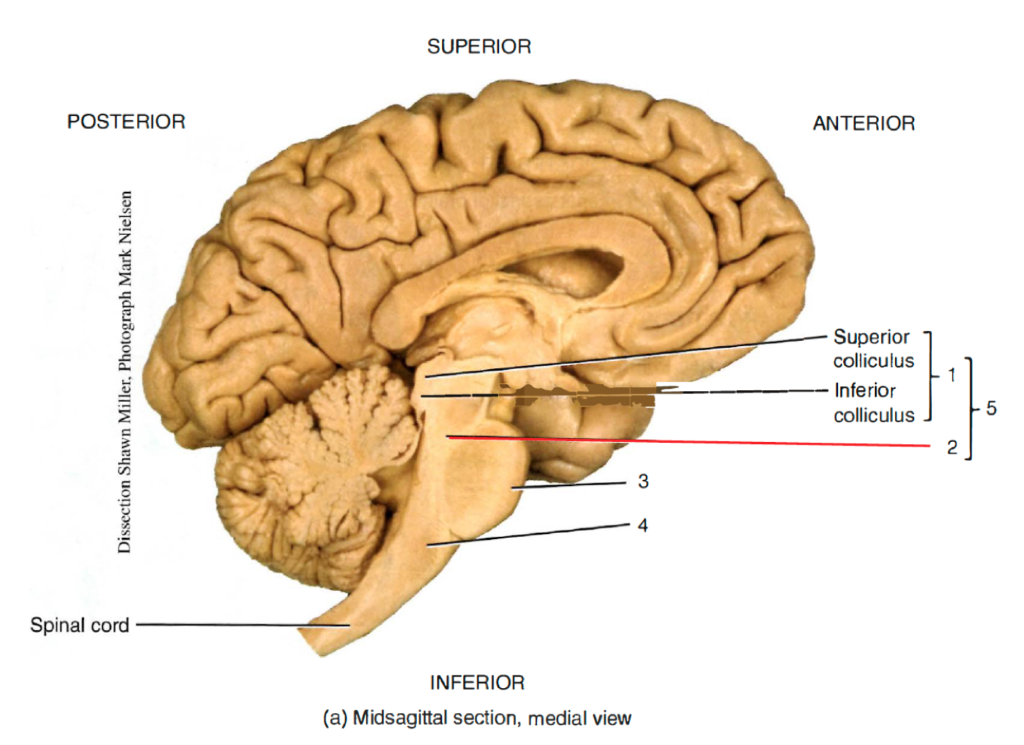 Solved Label the brain stem structures in the | Chegg.com