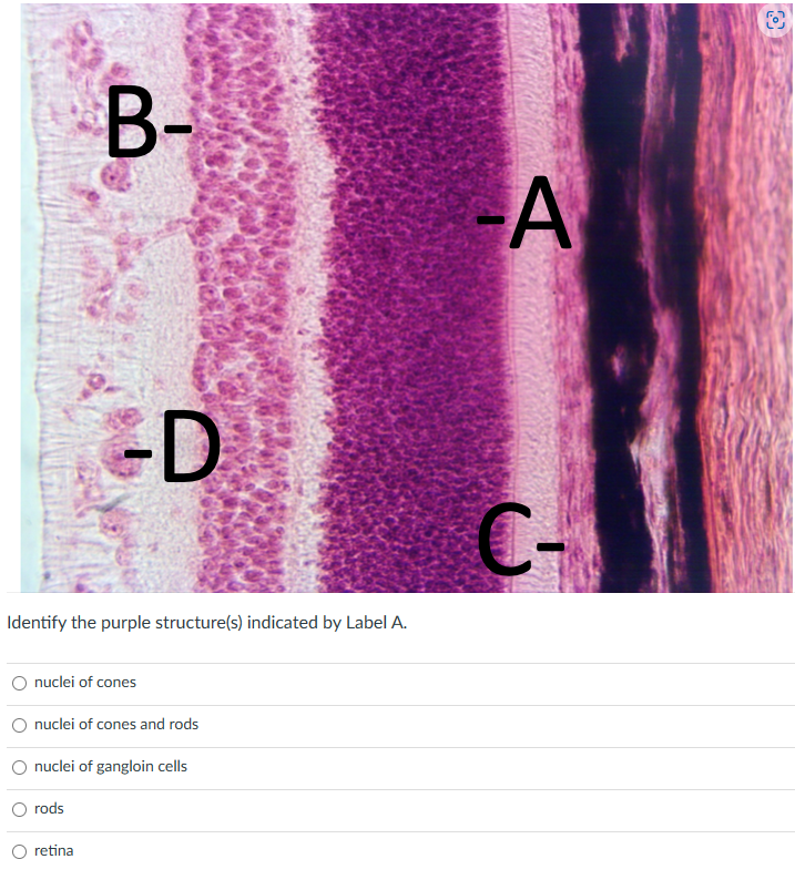 Solved The structure(s) indicated by Label A contains | Chegg.com