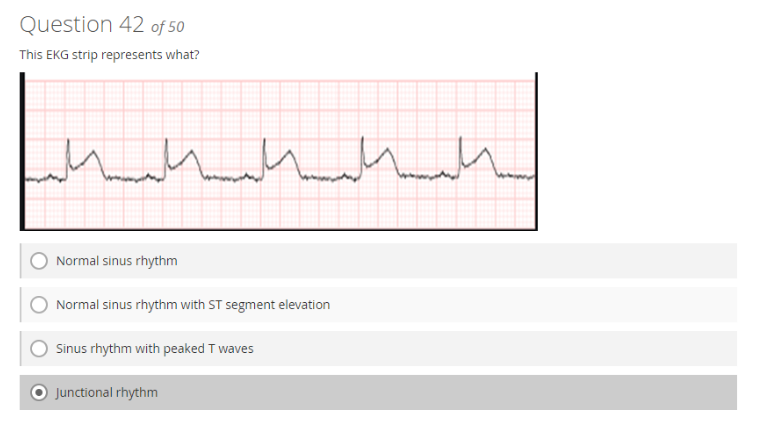 St Segment Elevation Strip
