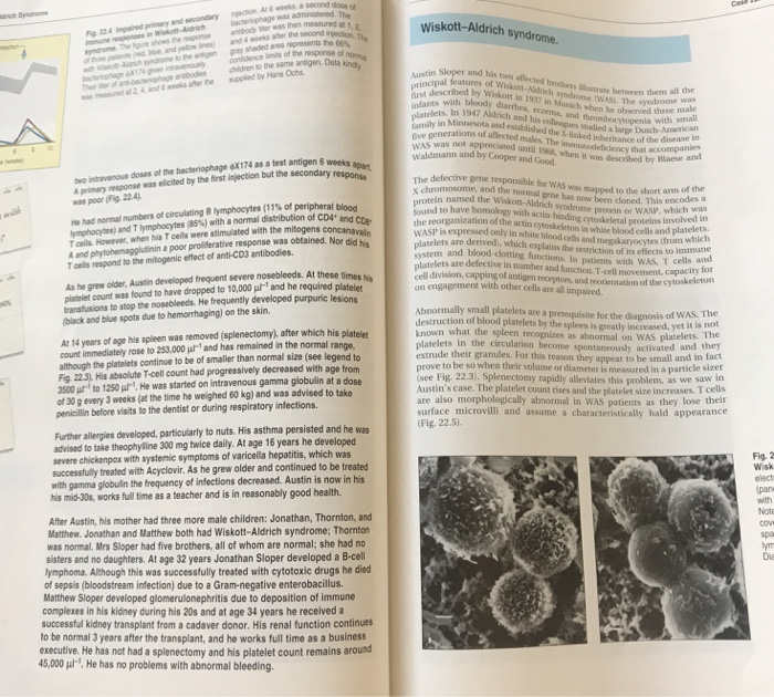 Solved The case of Austin Sloper: the consequences of a | Chegg.com