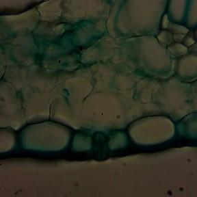 Solved Label the guard cells, subsidiary cells, and | Chegg.com