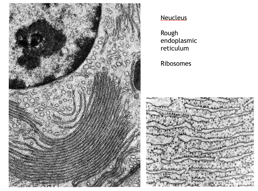 Solved Identify structures in the EM micrographs Match the | Chegg.com