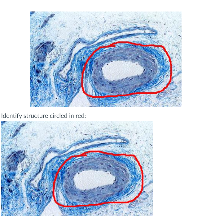 Solved Identify structure circled in red: | Chegg.com