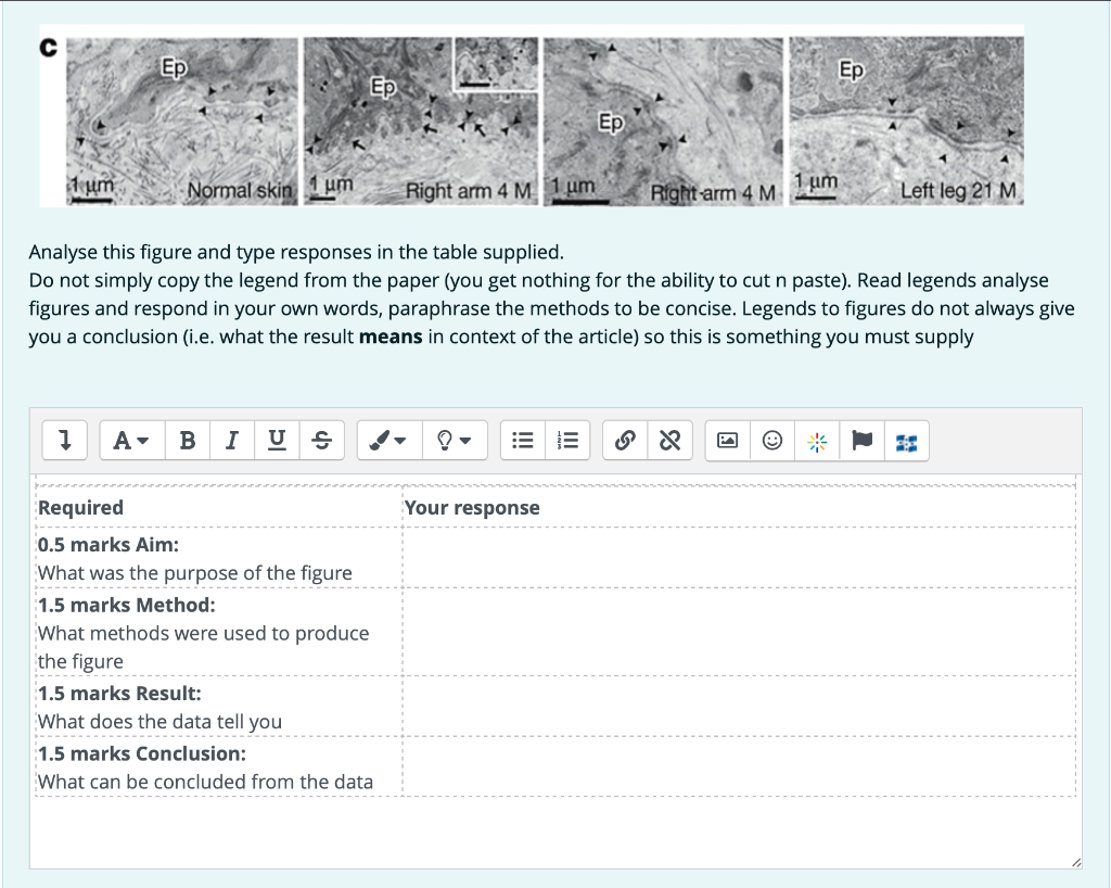 Solved Ер Ep Ep Ер Hum Normal skin 1 um Right arm 4 M 1 um 1 | Chegg.com