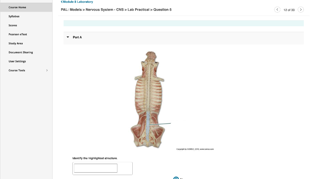 Solved PAL: Models > Nervous System - CNS > Lab Practical > | Chegg.com Solved PAL: Models > Nervous System - CNS > Lab Practical > | Chegg.com
