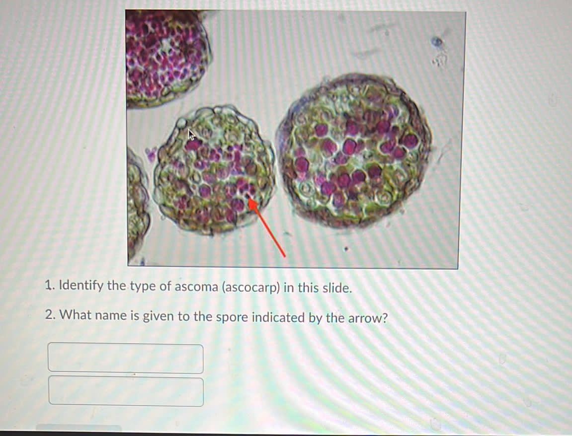 Solved 1. Identify the type of ascoma (ascocarp) in this | Chegg.com