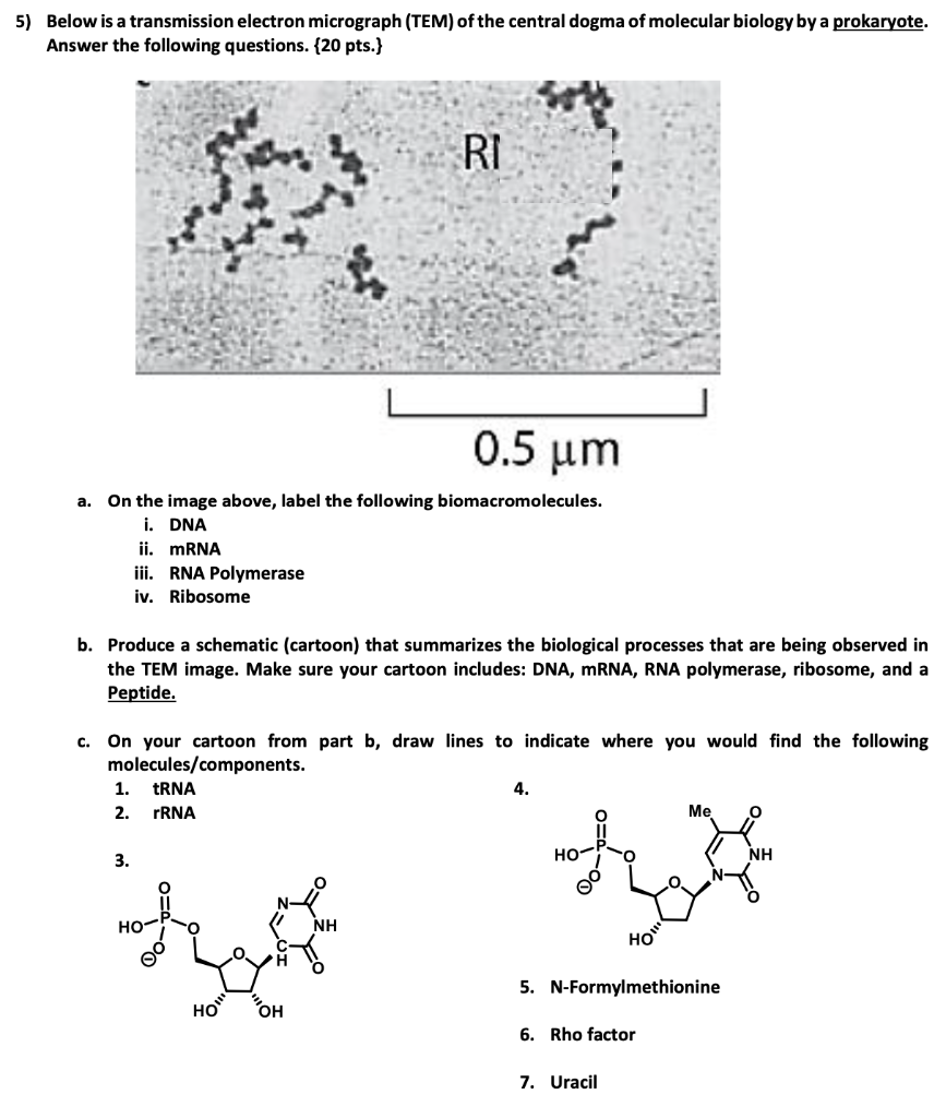 5) Below is a transmission electron micrograph (TEM) | Chegg.com