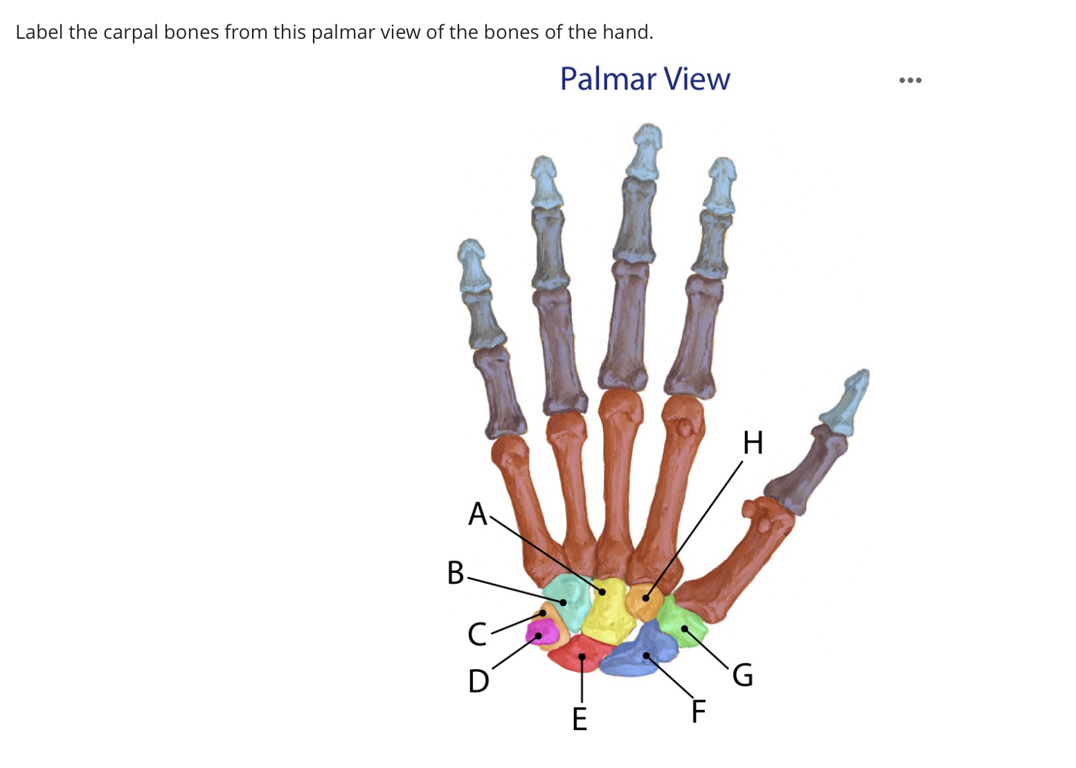 Solved Label the carpal bones from this palmar view of the | Chegg.com