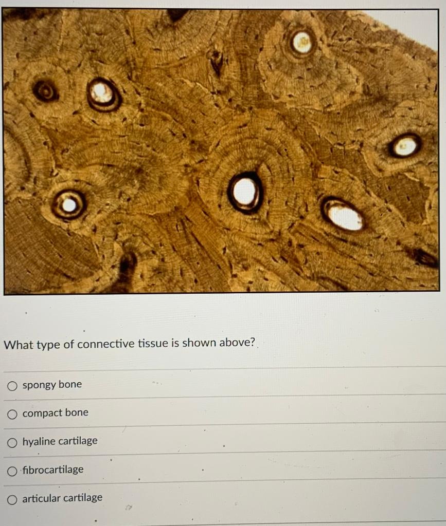 Solved What type of connective tissue is shown above? spongy | Chegg.com