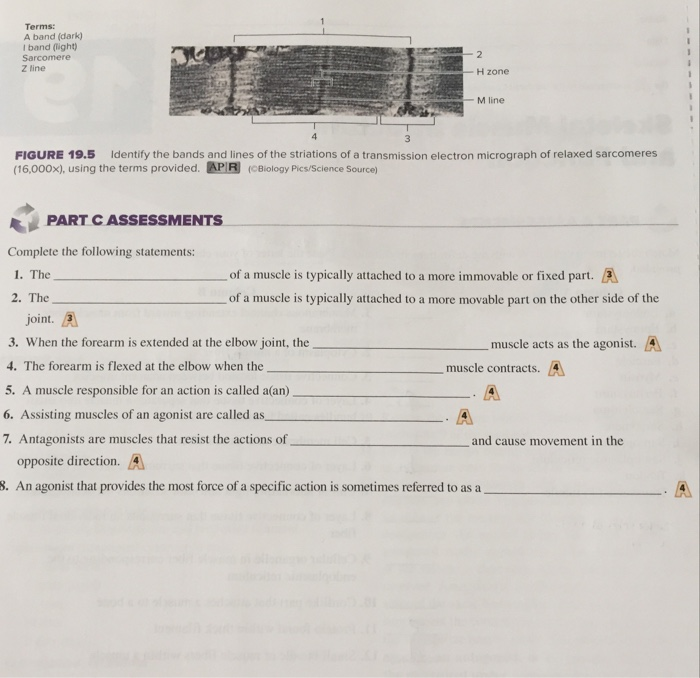 Solved Terms: A band (dark) I band (light) Z line H zone M | Chegg.com